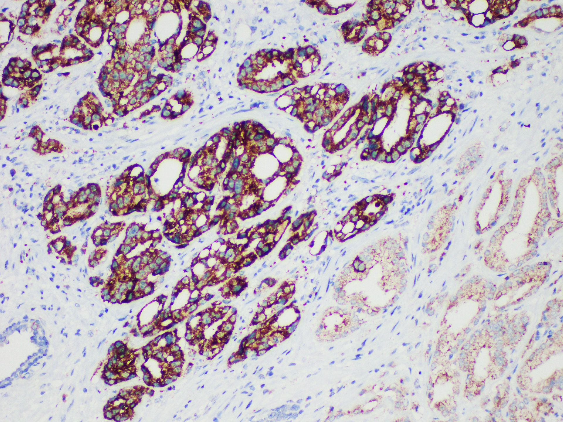 Polymer HRP (Mouse/Rabbit) IHC Kit (DAB)-S - PRODUCTS - Immunoway